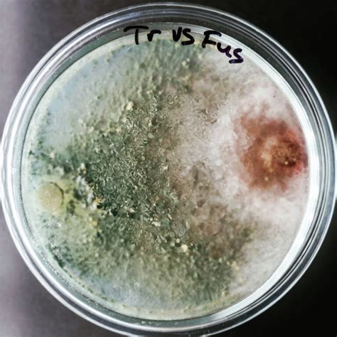 STD Testing Malaysia Fast Private Reliable Screening He Medical Clinic