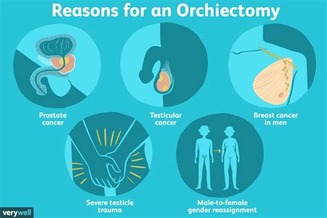 What Does Sex Look Like After A Testicle Removal Healthy Food Near Me