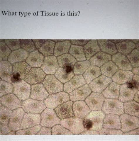 Solved What Type Of Tissue Is This Chegg Com