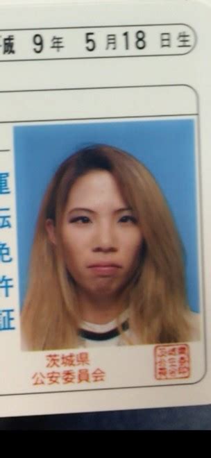 画像・写真 にゃいりんさんの整形ビフォーアフター 5枚目｜eltha（エルザ）