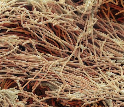 Bacillus Megaterium Bacteria Sem Stock Image C0207322 Science Photo Library