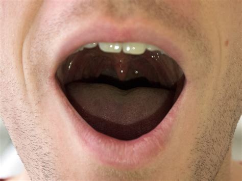 Glossopharyngeal Nerve Test