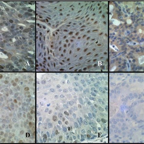 Example Of Immunohistochemical Staining Of Survivin In Canine Nasal