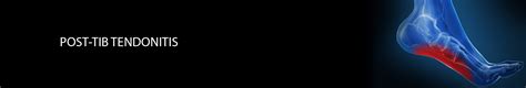 Post Tib Tendonitis Foot Plus