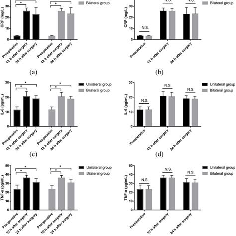 Alteration Of The Levels Of Serum Crp Il 6 And Tnf α In Unilateral
