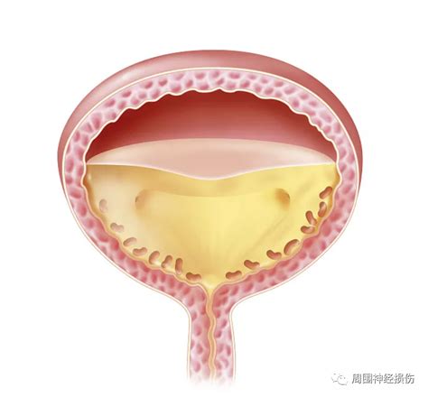 神经损伤为什么会导致大小便失禁？ 哔哩哔哩