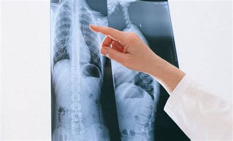 Badanie Rtg Wskazania I Przeciwwskazania Przebieg Akcemed Pl