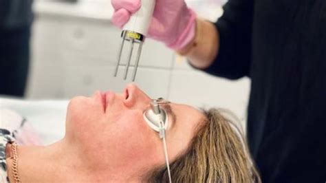 PICO Genesis Mampu Mengatasi Hal Berikut Ini HEYSTETIK