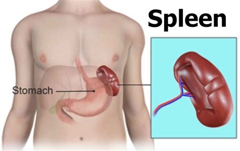 Splenectomy Indications Surgery Vaccines Diet Side Effects