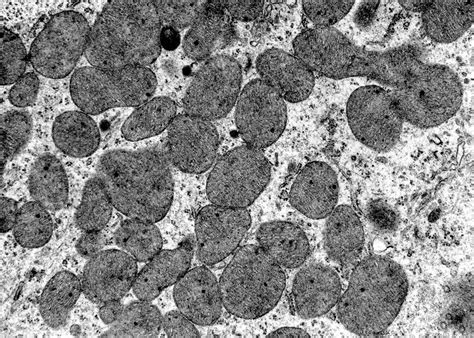 Mitochondria Tem Stock Image C036 0990 Science Photo Library