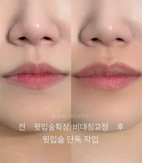 브로우니 • 멜라닌케어 일산눈썹문신 파주눈썹문신 일산입술문신 립라인교정 입술확장 무통반영구제거 아이라인 속눈썹펌 본연의 입술색에 맞춰 조색 후 자연스러움을 목표로