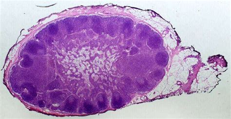 Histología De Los Ganglios Linfáticos Anatomía Embriología