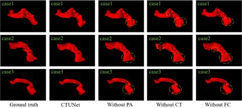 exhibition of segmentation results of 3d visualization ablation