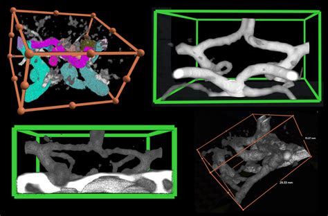 Cow Annotation Topology Aware Anatomical Segmentation Of The Circle