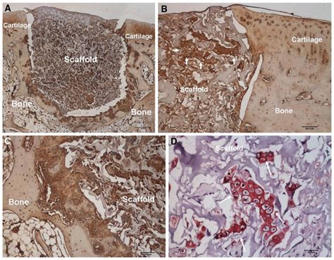 A Aggrecan Staining At 1 Month Demonstrates No Degeneration Of The
