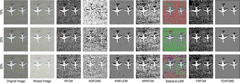 Comparison Of Segmentation Results On The Ct Liver Image When It Is