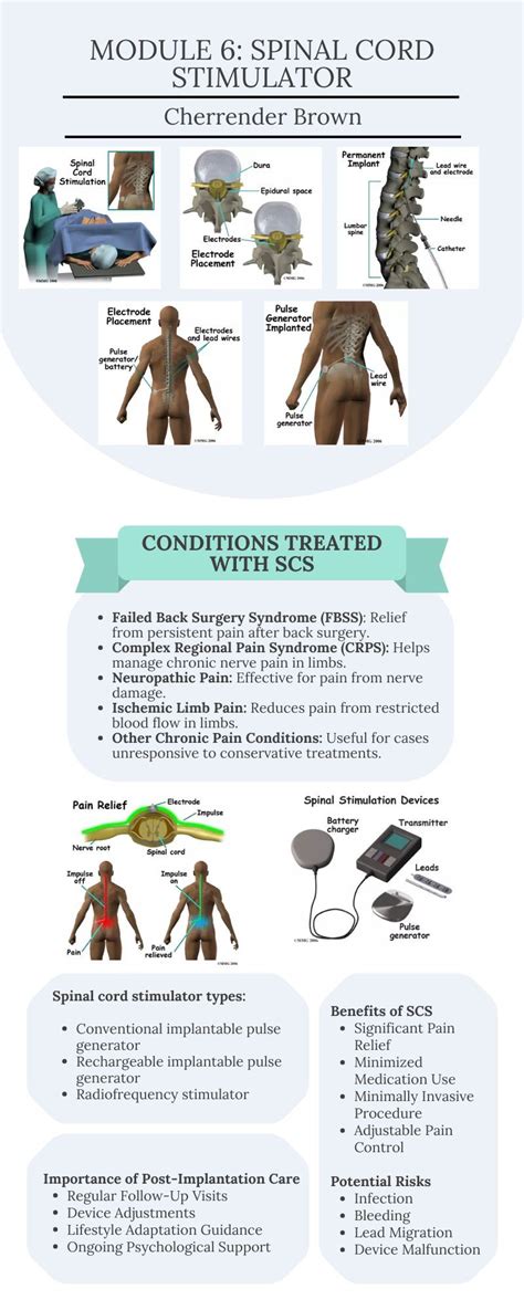 Global Innervation Llc On Linkedin Spinal Cord Stimulation Mapping Neuromonitoring