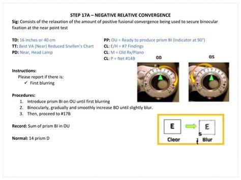 21 Steps With Preliminary Tests Optometry Pdf