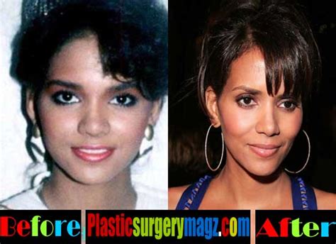 Halle Berry Nose Job Before And After Plastic Surgery Magazine