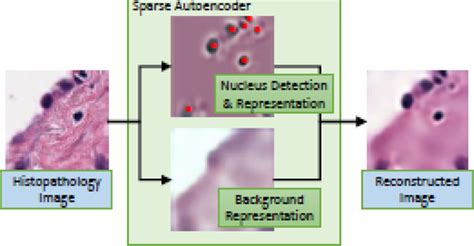 Sparse Autoencoder For Unsupervised Nucleus Detection And Representation In Histopathology