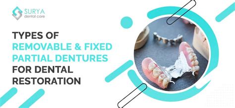 5 Different Types Of Partial Dentures