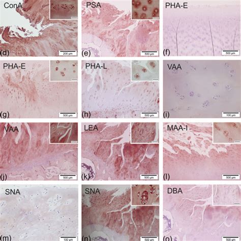 Lectin Histochemical Staining Profiles In Sections Of Oa Cartilage A