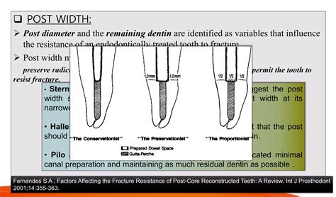 Rehabilitation Of Endodontically Treated Teeth Post And Core Pptx