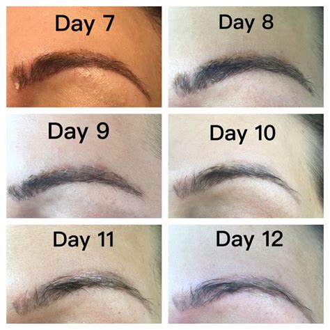 Microblading Healing Days 7 12 Oily Skin Day By Day Microblading