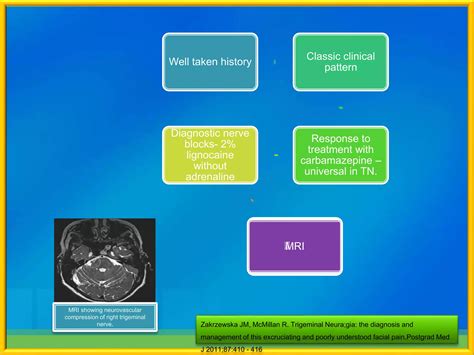 Trigeminal Neuralgia Dr Sanjana Ravindra Pptx Brain And Nervous System Disorders