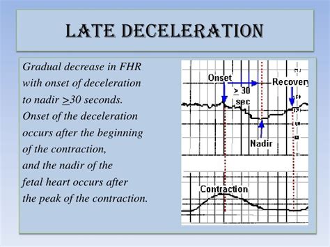 Late Deceleration Labor And Delivery Labor Delivery Nursing Labor Delivery Nurse