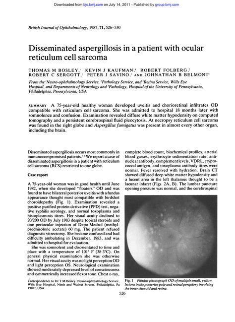 Pdf Disseminated Aspergillosis In A Patient With Ocular Reticulum