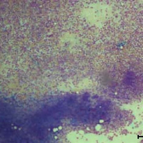 Micrograph Showing Hypercellularity With Prominent Proliferation Of Download Scientific Diagram