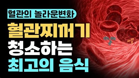 혈관 찌꺼기를 청소하는 최고의 음식 이것을 매일 먹었더니 혈관에 놀라운 변화가 찾아온다 Youtube