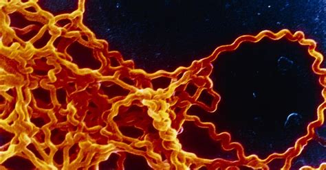 O Que é Leptospirose Análises Clí