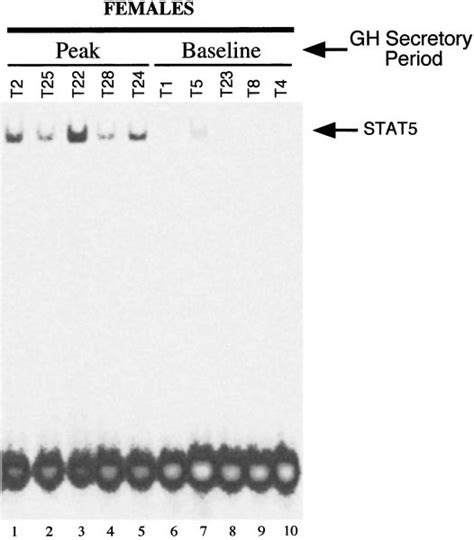 Stat5 Dna Binding Activity Assayed In Livers Of The Individual Adult