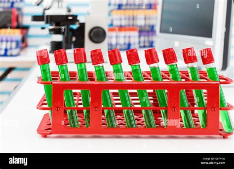Green Liquid In The Test Tubes In Laboratory With Microscope Stock