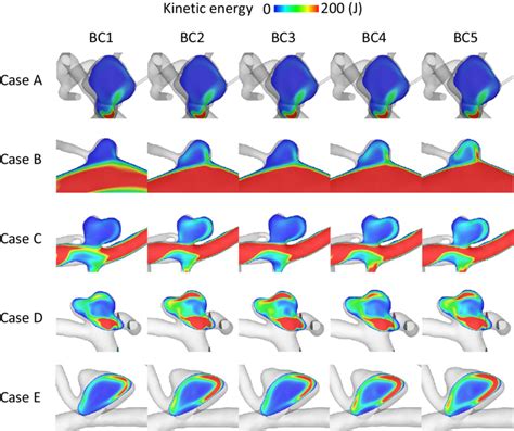 Contours Through Aneurysm Model Colored With Ke Within Each Ia Rows Download Scientific
