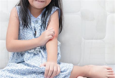 Premium Photo Girl Scratch The Itch With Hand Concept With Healthcare And Medicine