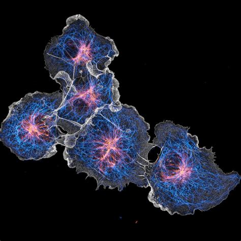 Christophe Leterrier On Linkedin Microscopymonday Cellfie 11 Comments