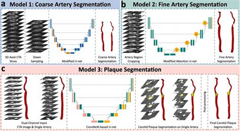 Cap Net Carotid Artery Plaque Segmentation System Based On Computed