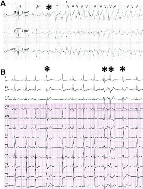 A Telemetry Tracing Shows An Episode Of Sustained Polymorphic Download Scientific Diagram