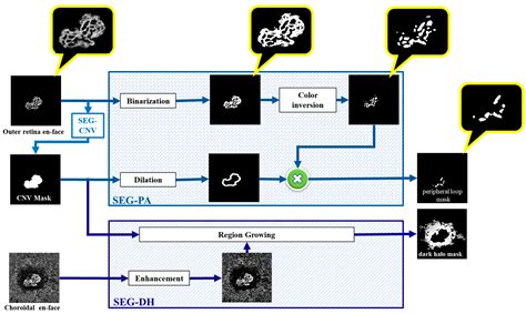 Github Mahsavalicnv Segmentation Classification Octa Cnv Net Segmentation Classification
