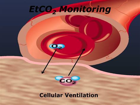 Ppt End Tidal Co 2 Etco 2 Monitoring Powerpoint Presentation Free