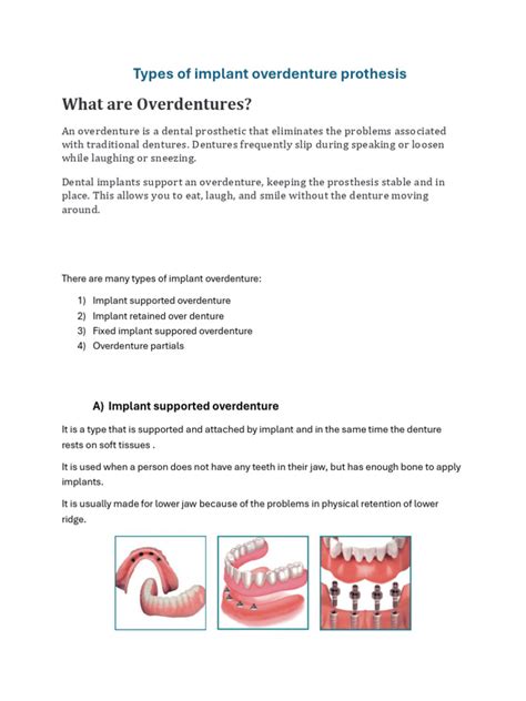 What Are Overdentures Types Of Implant Overdenture Prothesis Pdf