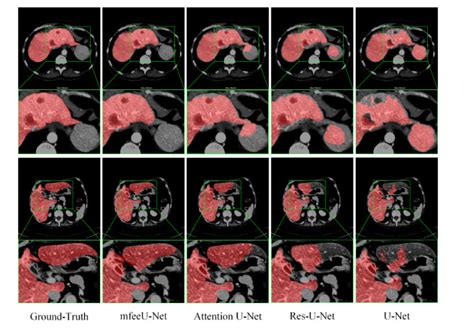 Mfeeu Net A Multi Scale Feature Extraction And Enhancement U Net For