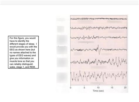 Eeg Image Diagram Quizlet