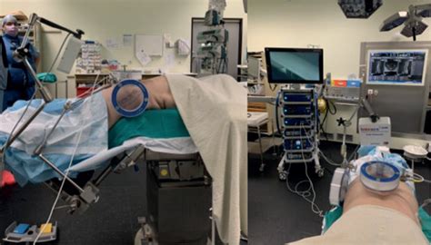 patient installed in prone position the two mappers and the