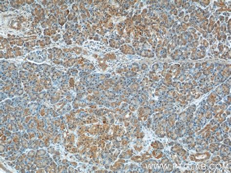 Ephb4 Antibody 20883 1 Ap Proteintech