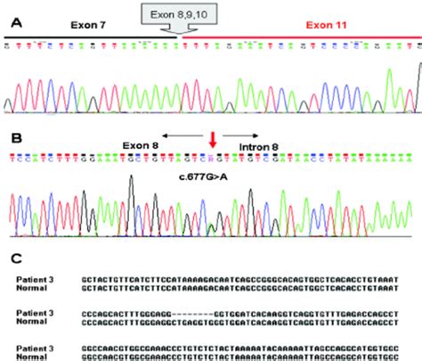 Characterization Of Mlh1 In Patient 3 Sequencing Pattern Of The Region