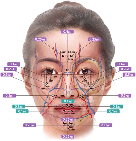 Pin By Morgana Sales On Anatomia Do Rosto Facial Injections Botox
